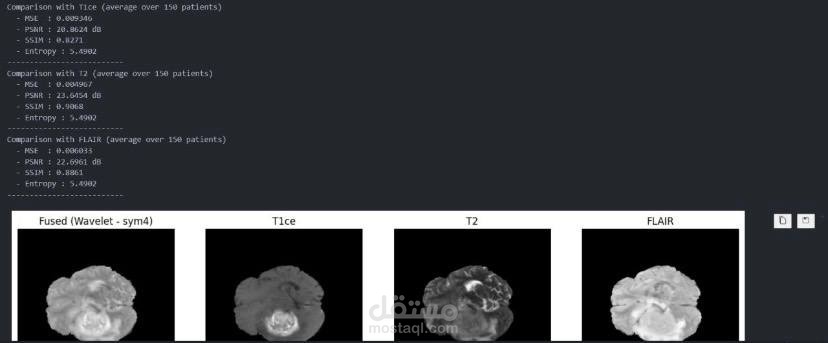 Multimodal MRI Brain Tumor Image Fusion Pipeline | AI & Bioinformatics ...