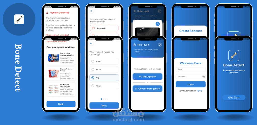 Bone Detect app | مستقل